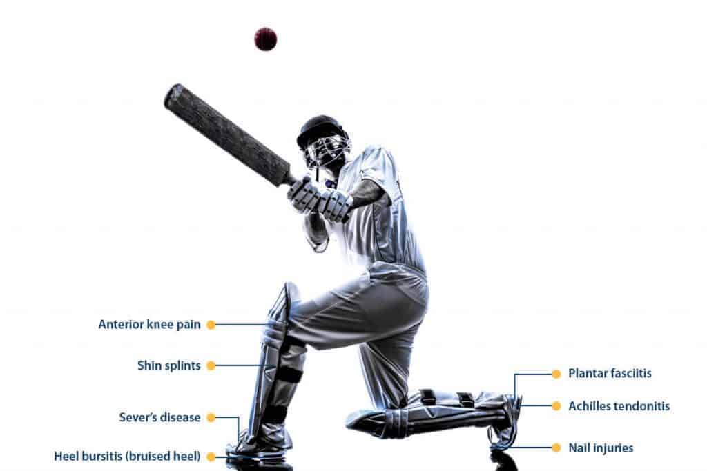 Cricket | My FootDr Singapore